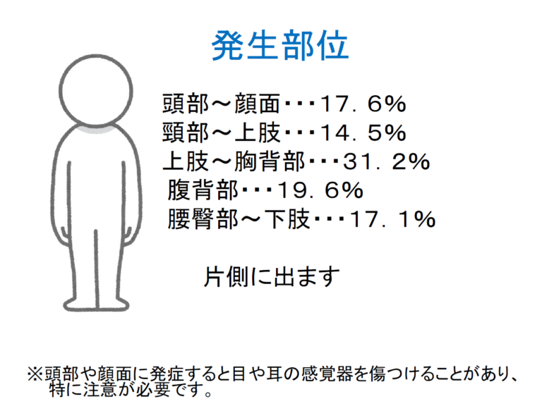 看護師からの健康アドバイス お知らせ 帯状疱疹の予防ワクチンについてのお知らせ 坂井輪診療所|新潟市西区 内科・消化器科|胃がん診断や